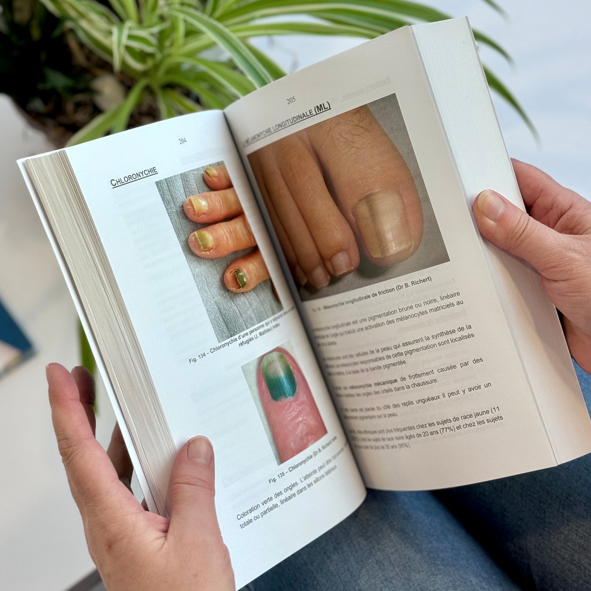 Équipements - Podo-Logic